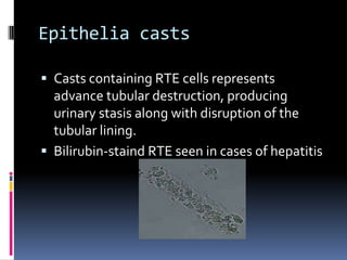 Microscopic examination of urinary sediments | PPTX