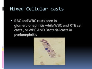 Microscopic examination of urinary sediments | PPTX