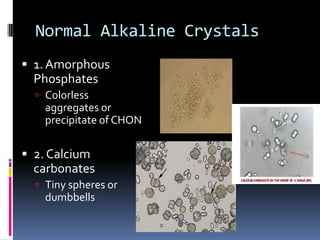 Microscopic examination of urinary sediments | PPTX