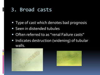 Broad Casts In Urine
