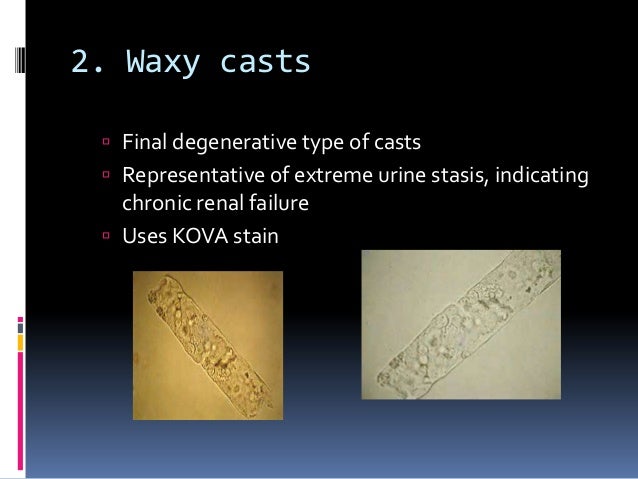 Microscopic examination of urinary sediments
