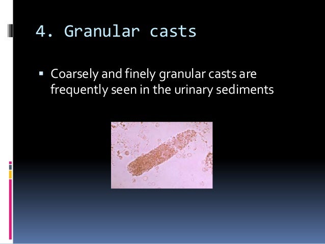 Microscopic examination of urinary sediments