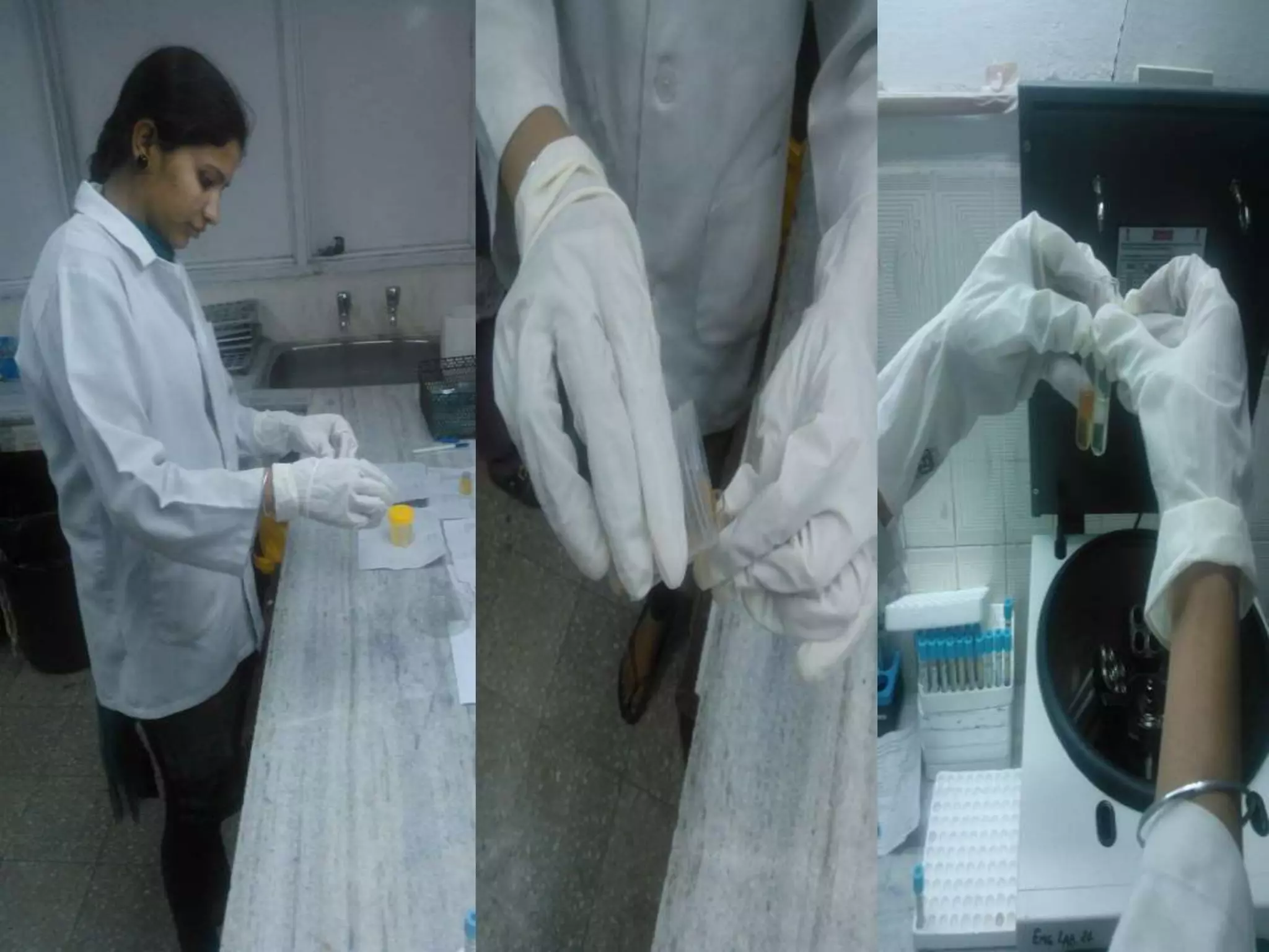 Microscopic examination of urine | PPTX