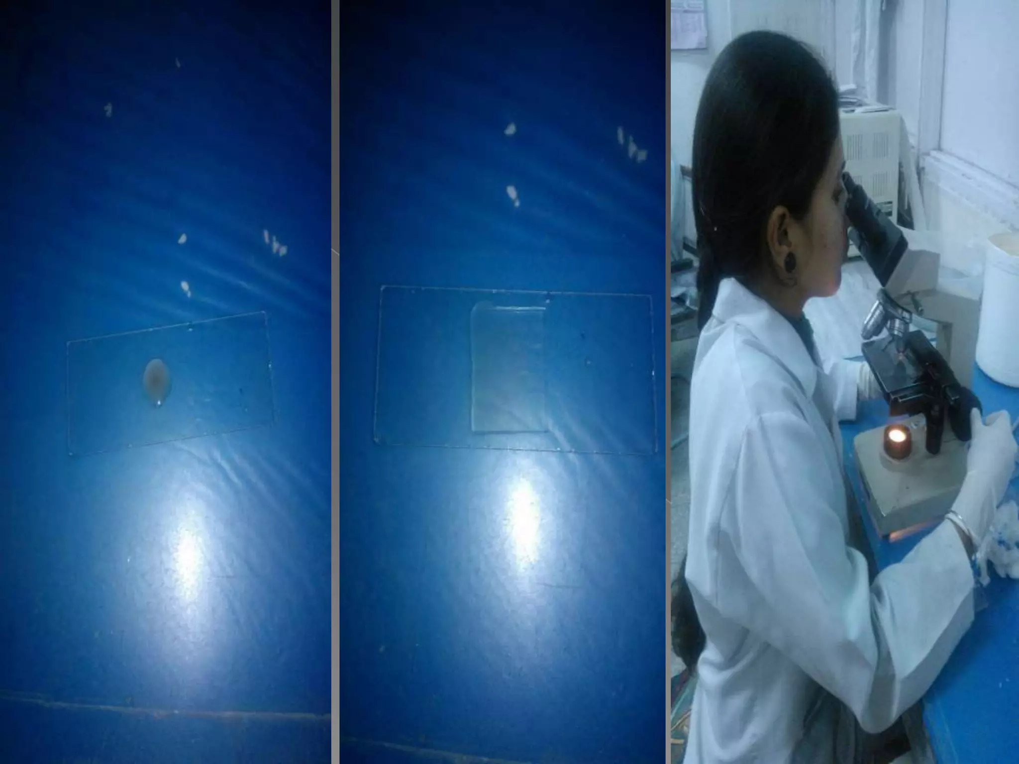 Microscopic examination of urine | PPTX