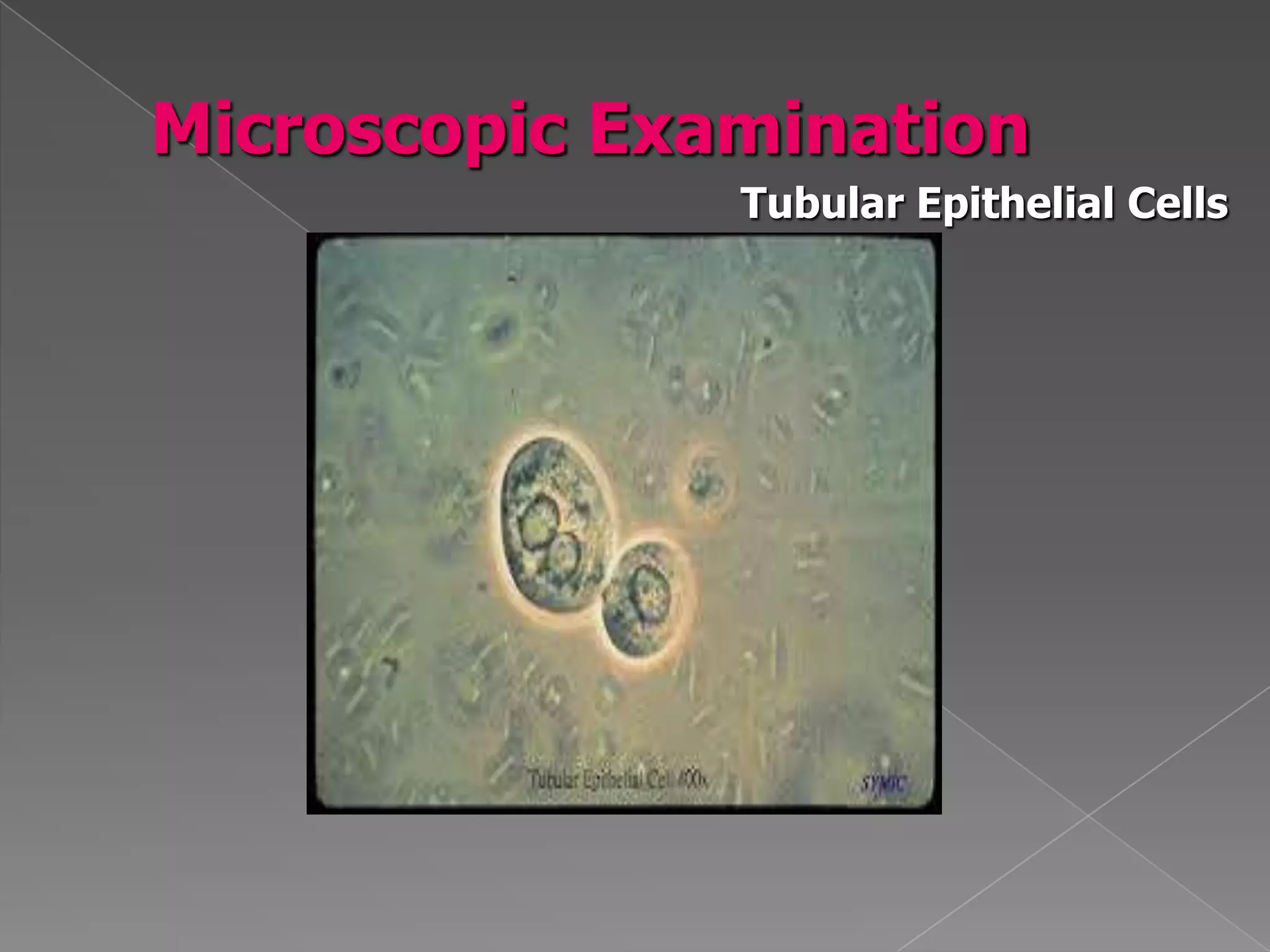 Microscopic examination of urine | PPTX