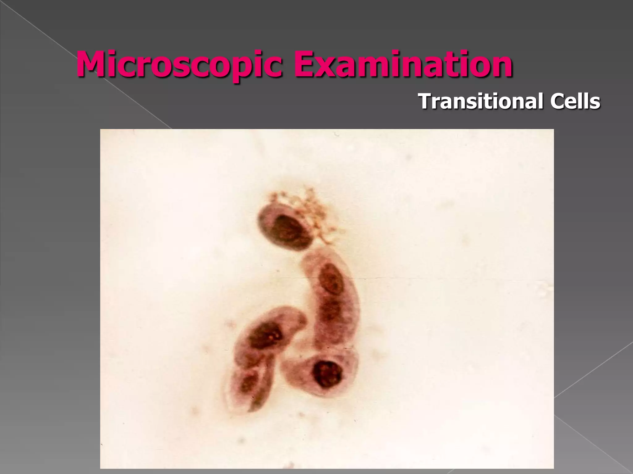 Microscopic examination of urine | PPTX