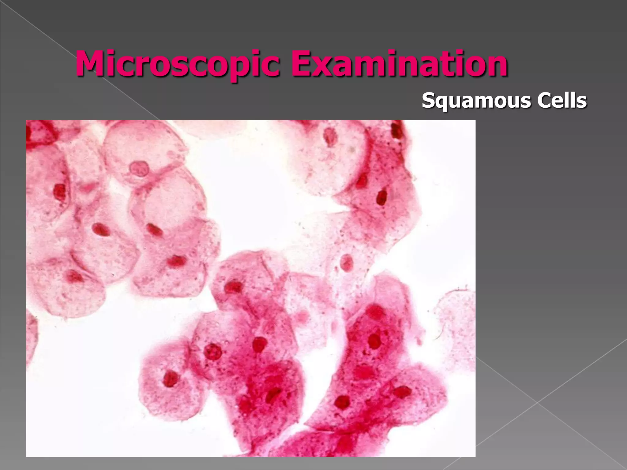 Microscopic examination of urine | PPTX