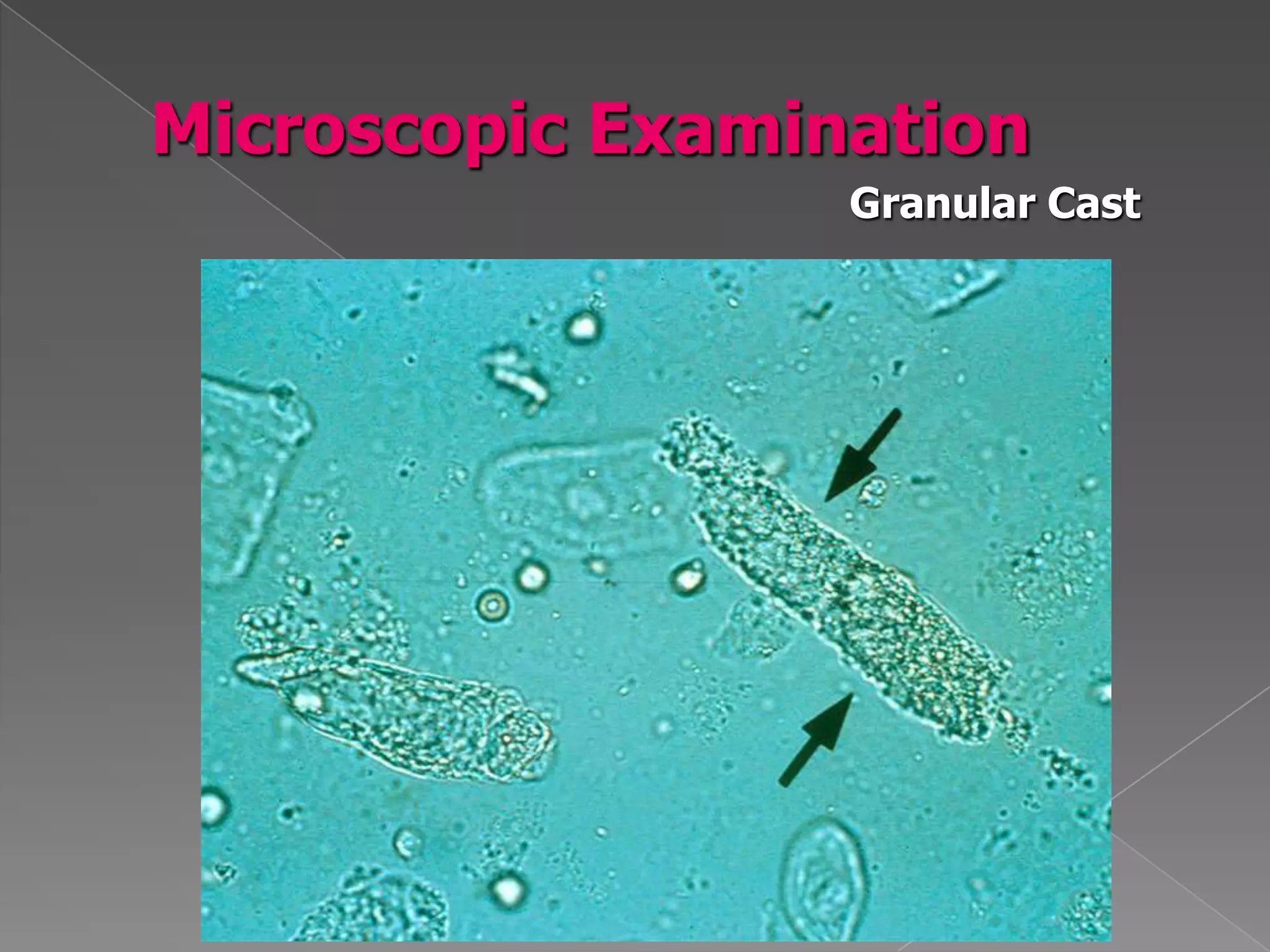 Microscopic examination of urine | PPTX