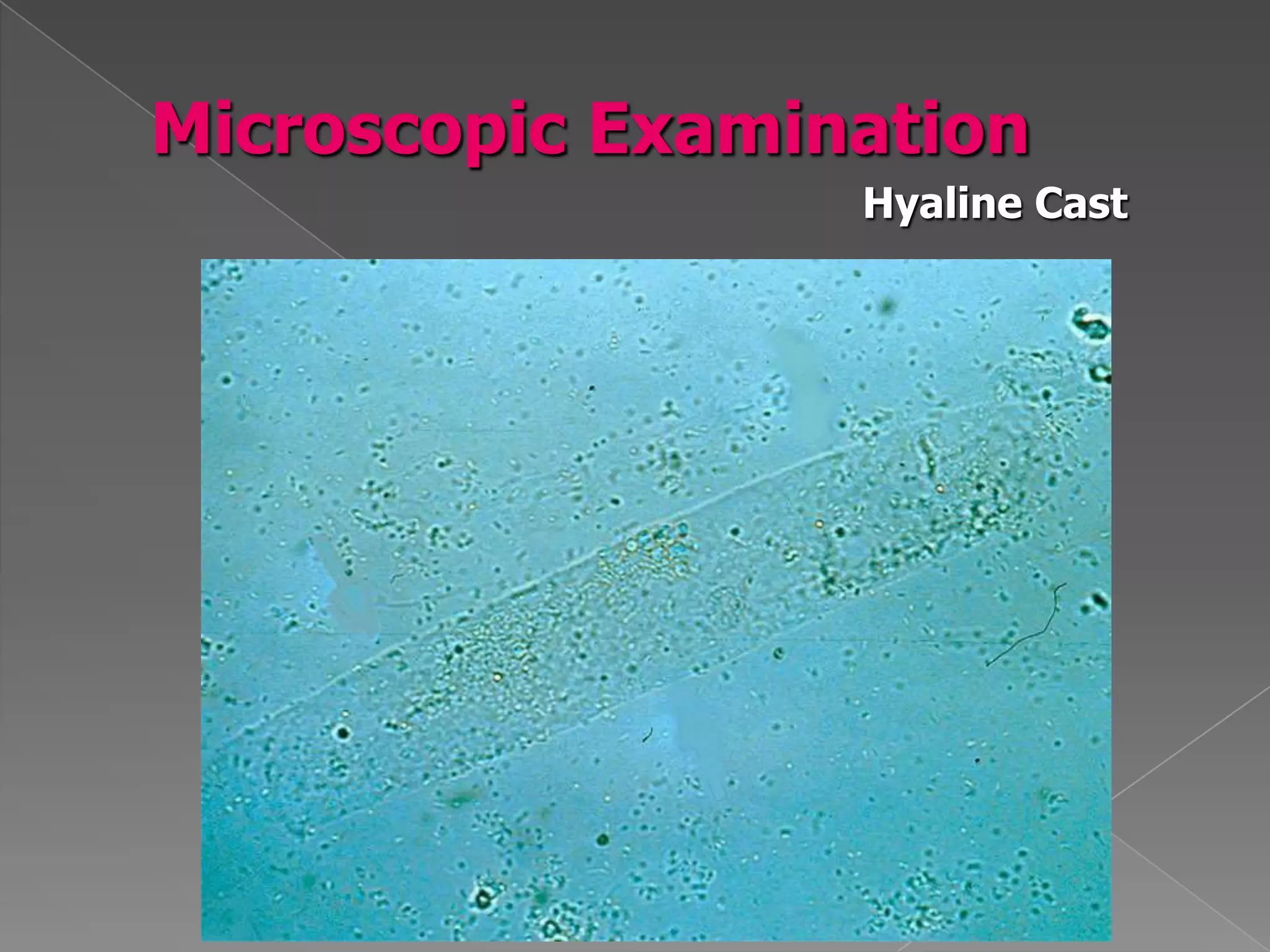 Microscopic examination of urine | PPTX