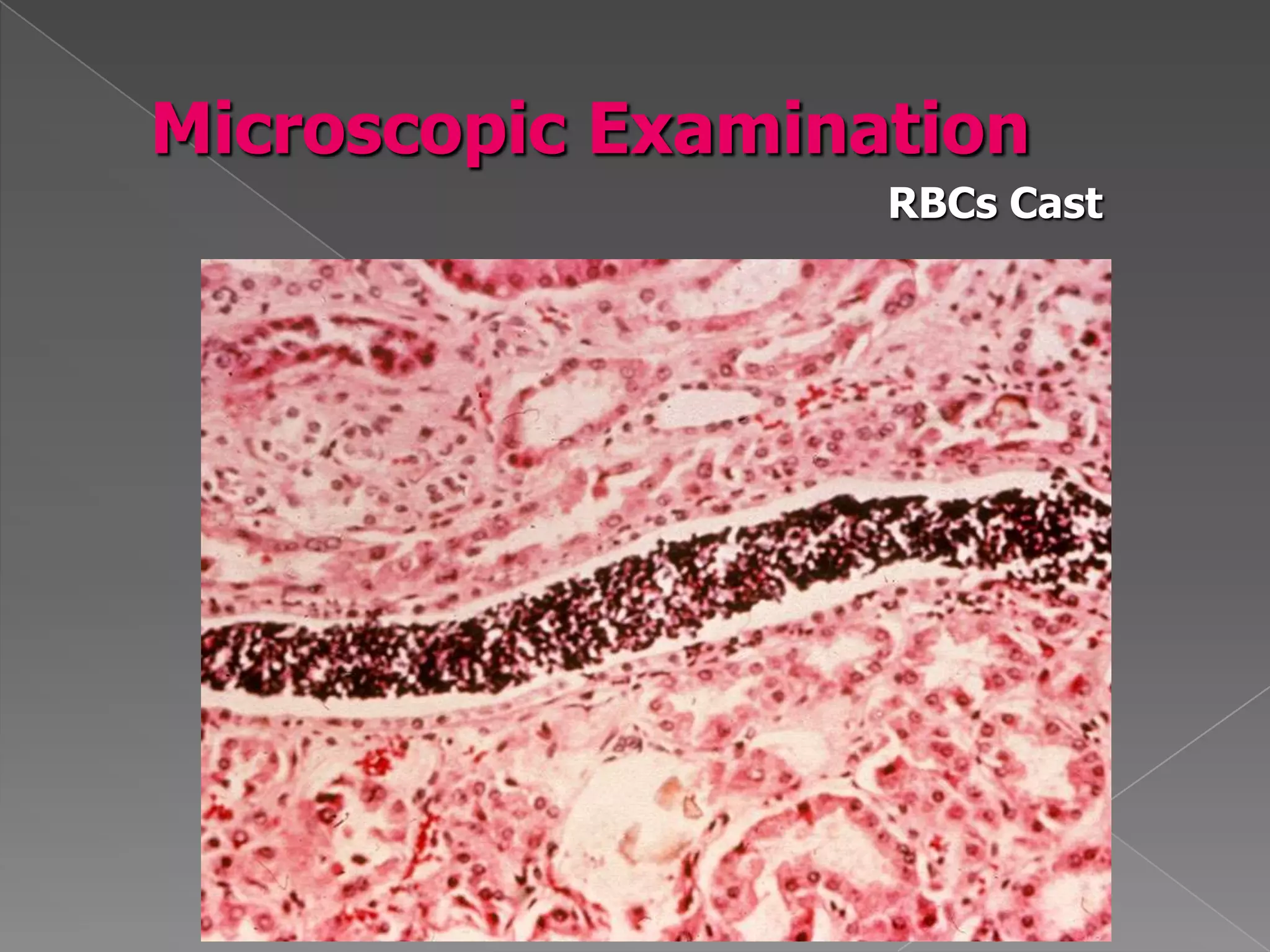 Microscopic examination of urine | PPTX