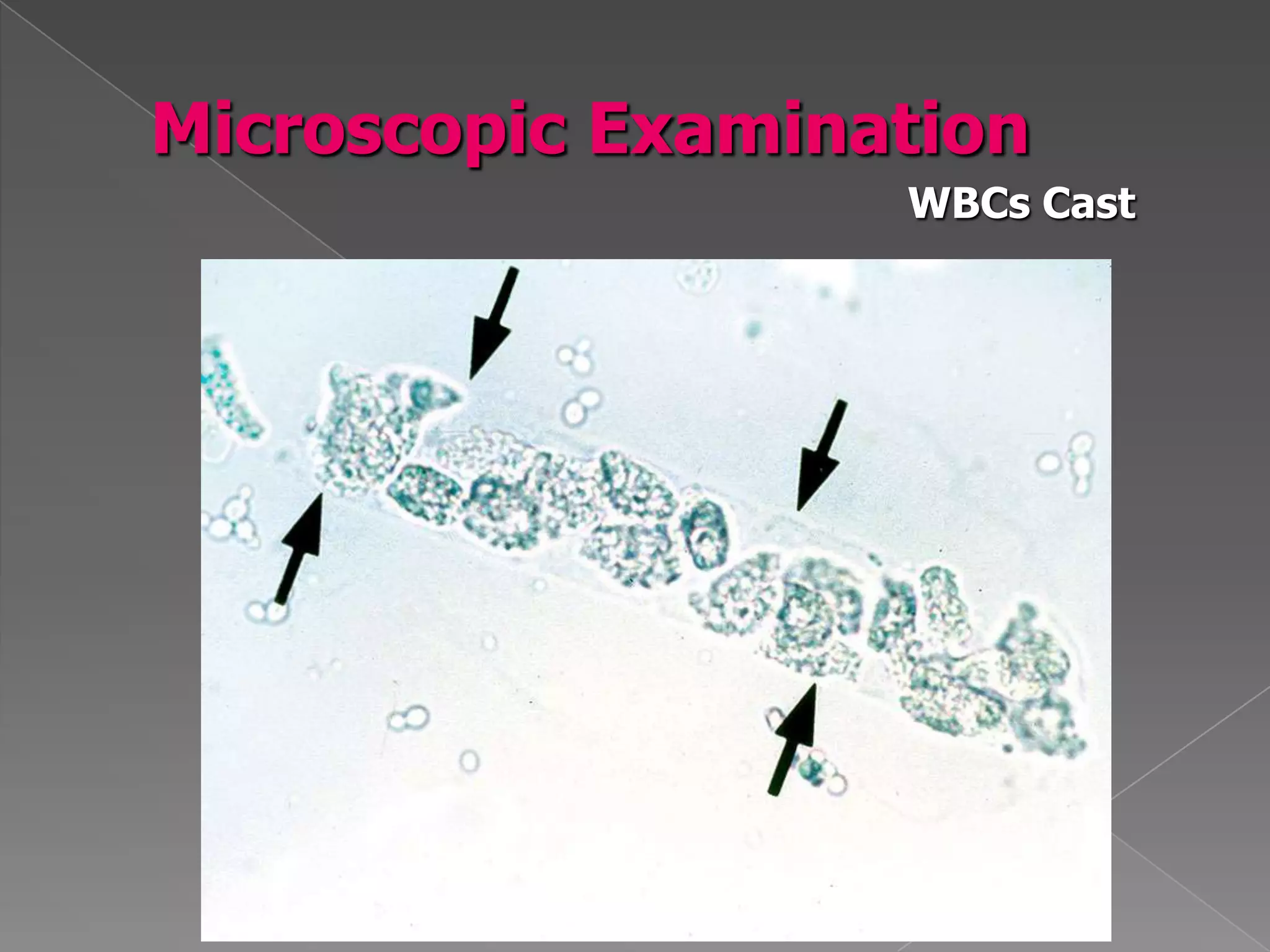 Microscopic examination of urine | PPTX