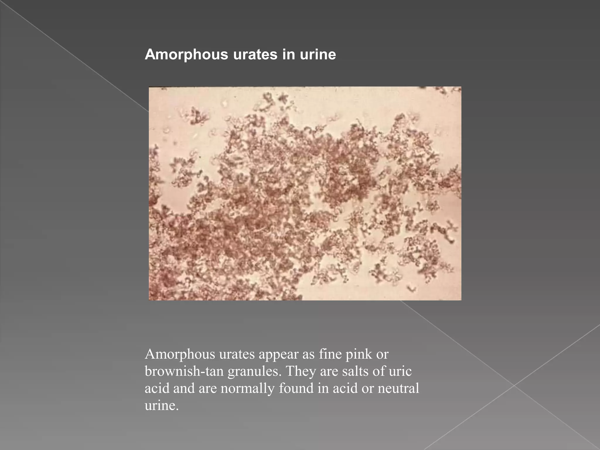 Microscopic examination of urine | PPTX