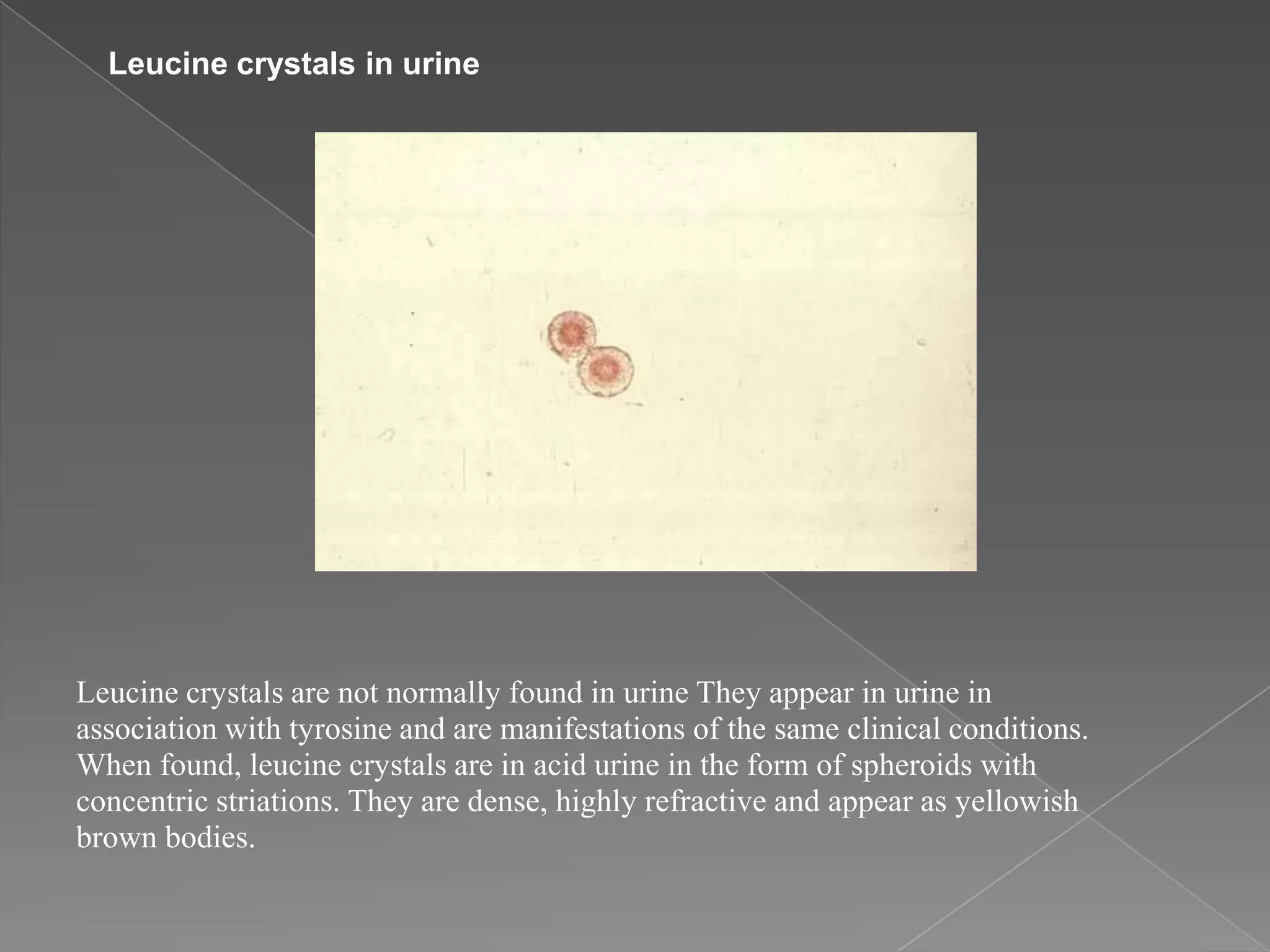 Microscopic examination of urine | PPTX