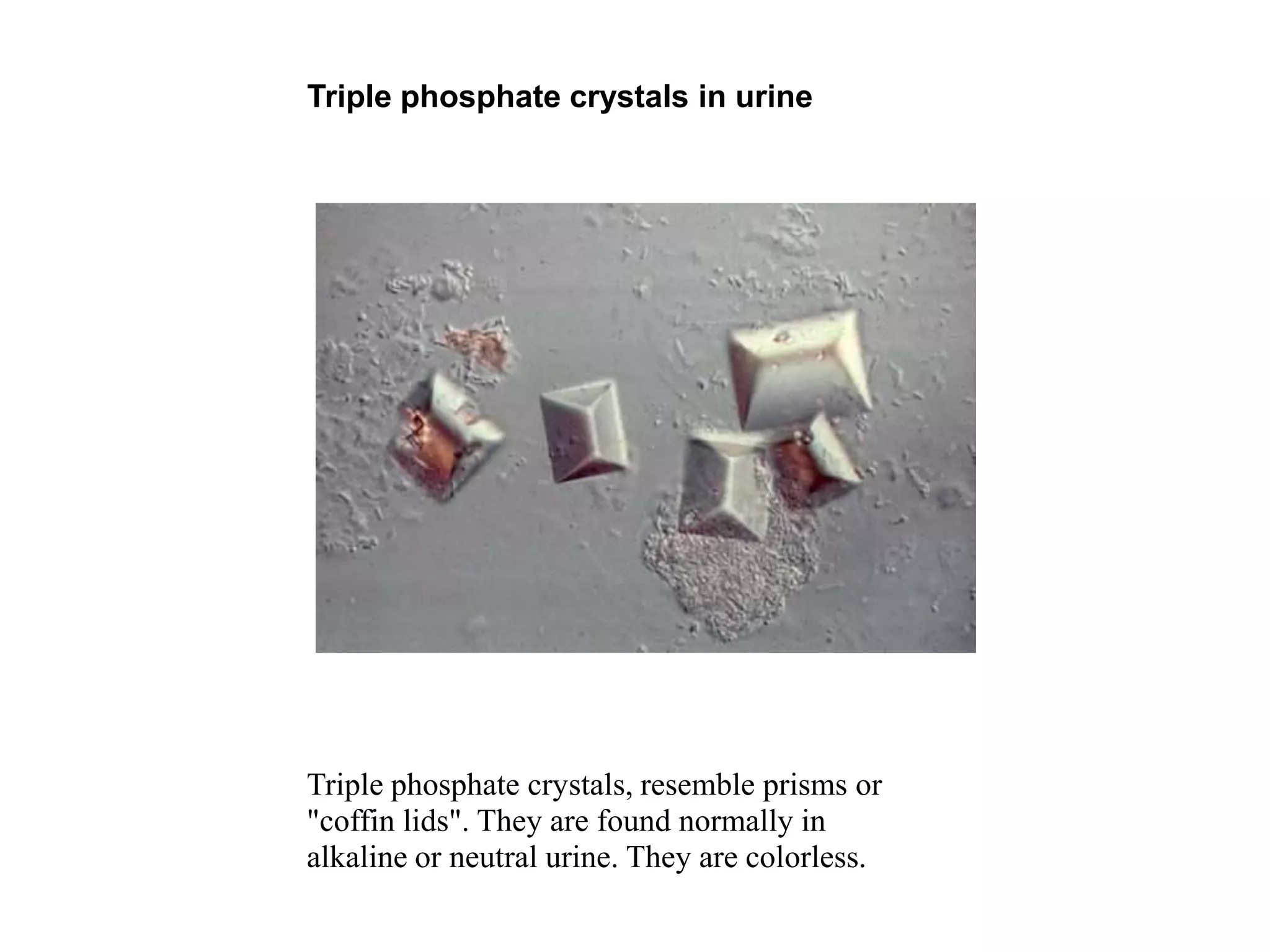 Microscopic examination of urine | PPTX