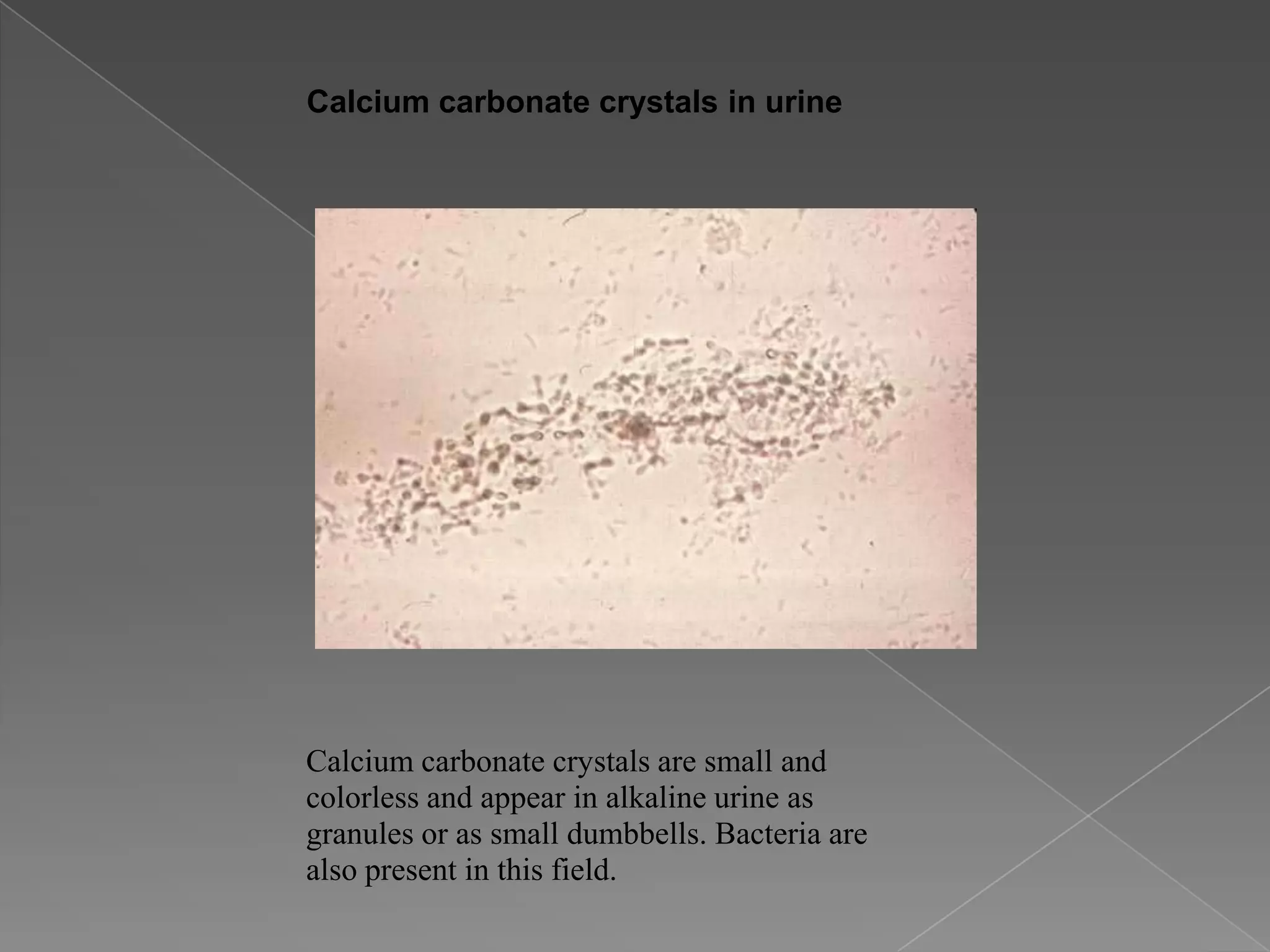 Microscopic examination of urine | PPTX