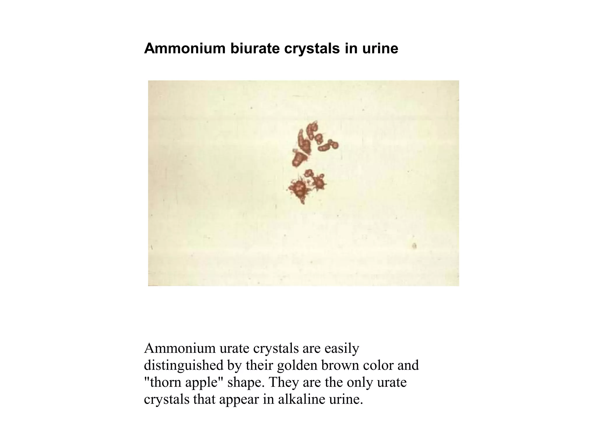 Microscopic examination of urine | PPTX