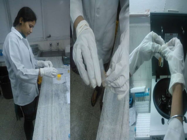 Microscopic examination of urine | PPTX