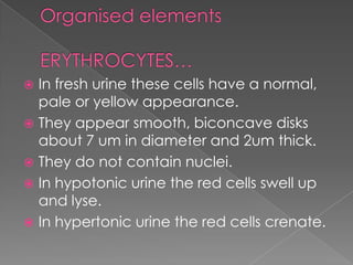 Microscopic examination of urine | PPTX
