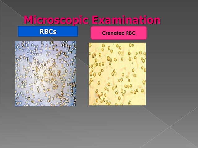 Microscopic examination of urine | PPTX