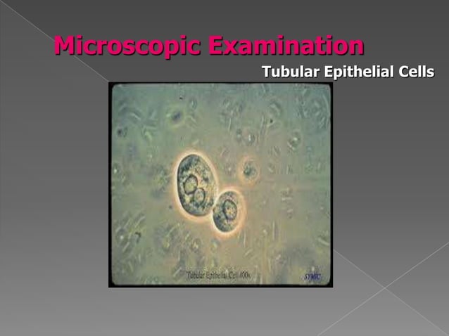 Microscopic examination of urine | PPTX