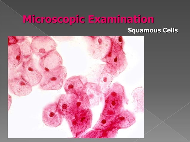 Microscopic examination of urine | PPTX