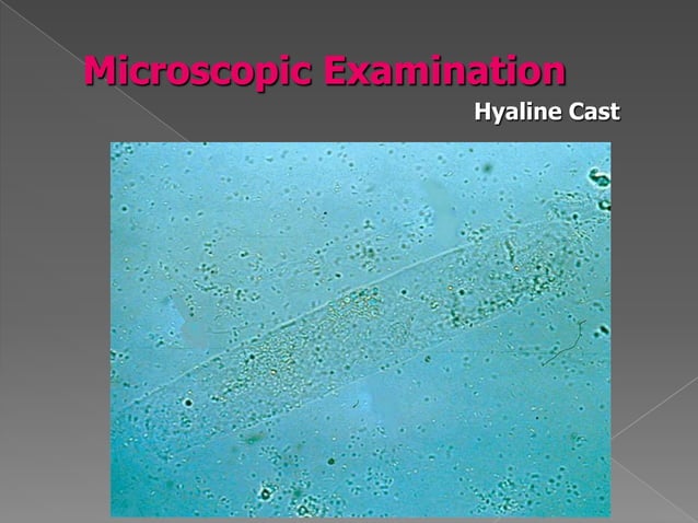 Microscopic examination of urine | PPTX