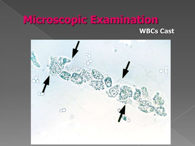 Microscopic examination of urine | PPTX