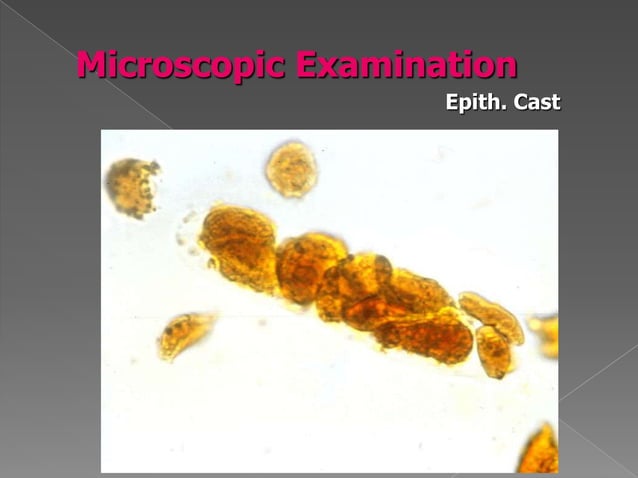 Microscopic examination of urine | PPTX
