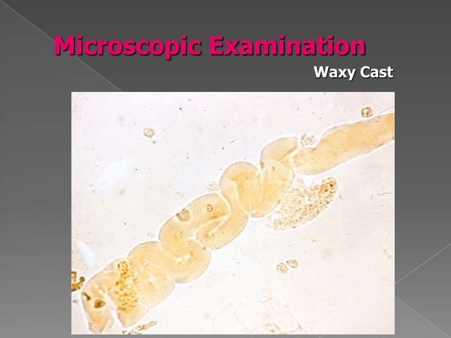 Microscopic examination of urine | PPTX
