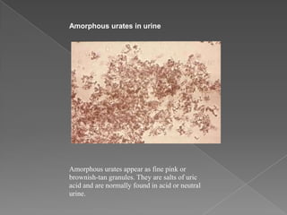 Microscopic examination of urine | PPTX
