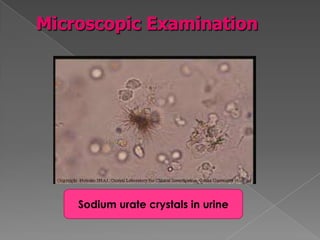Microscopic examination of urine | PPTX