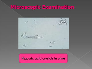 Microscopic examination of urine | PPTX