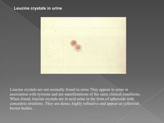 Microscopic examination of urine | PPTX