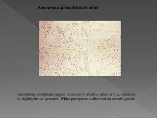 Microscopic examination of urine | PPTX