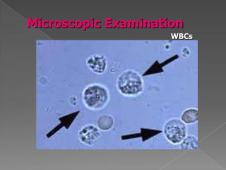 Wbc In Urine