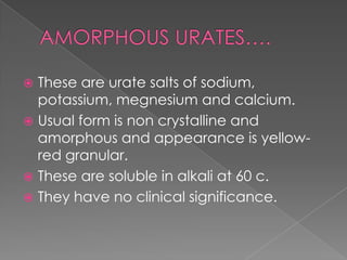 Amorphous Urates In Urine