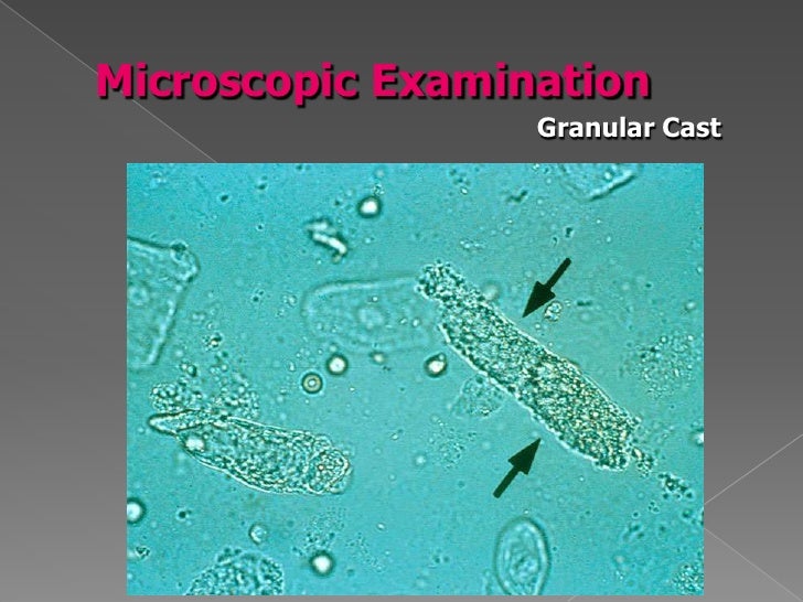 Microscopic examination of urine