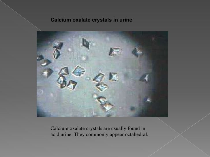Microscopic examination of urine