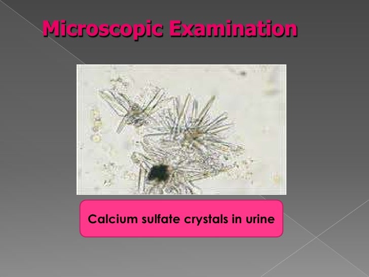 Microscopic examination of urine