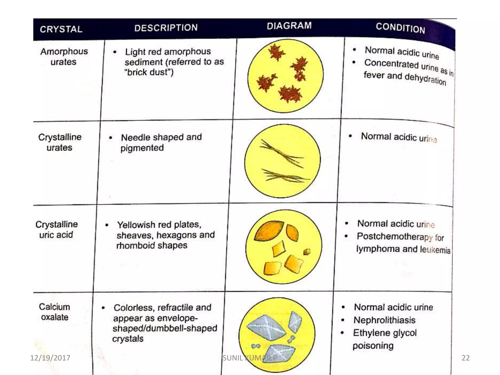 Microscopic examination of urine | PPTX
