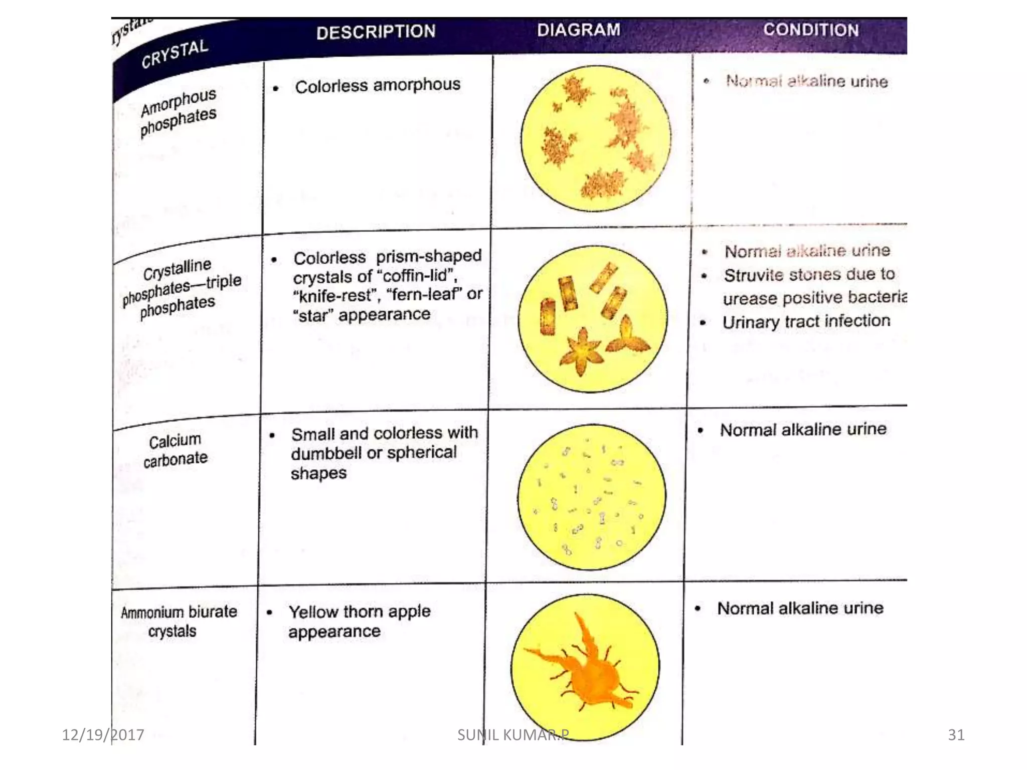 Microscopic examination of urine | PPTX