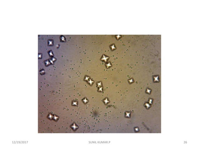 Microscopic examination of urine | PPTX | Blood Disorders | Diseases ...
