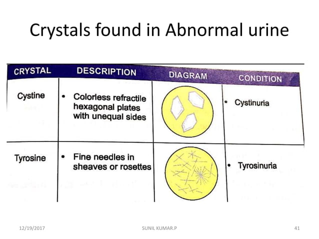 Microscopic examination of urine | PPTX | Blood Disorders | Diseases ...