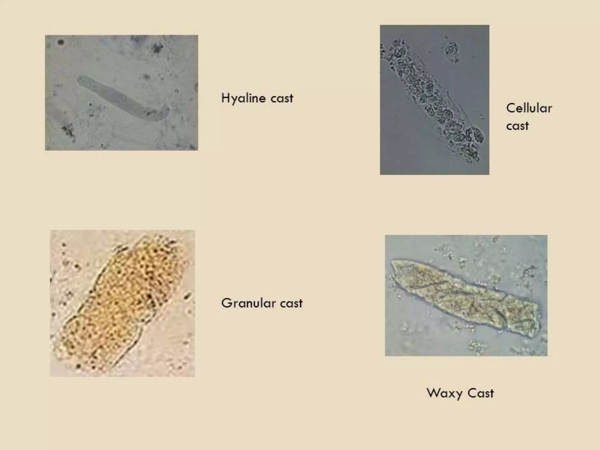 Microscopic examination of urine | PPTX