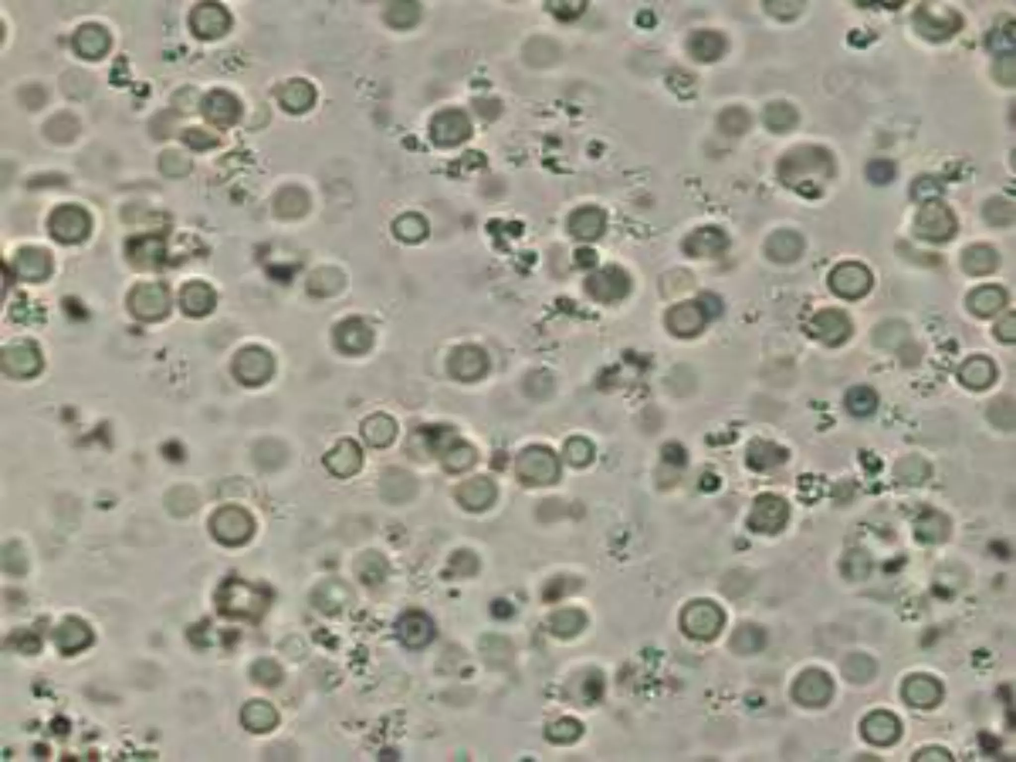 Microscopic examination of urine | PPTX