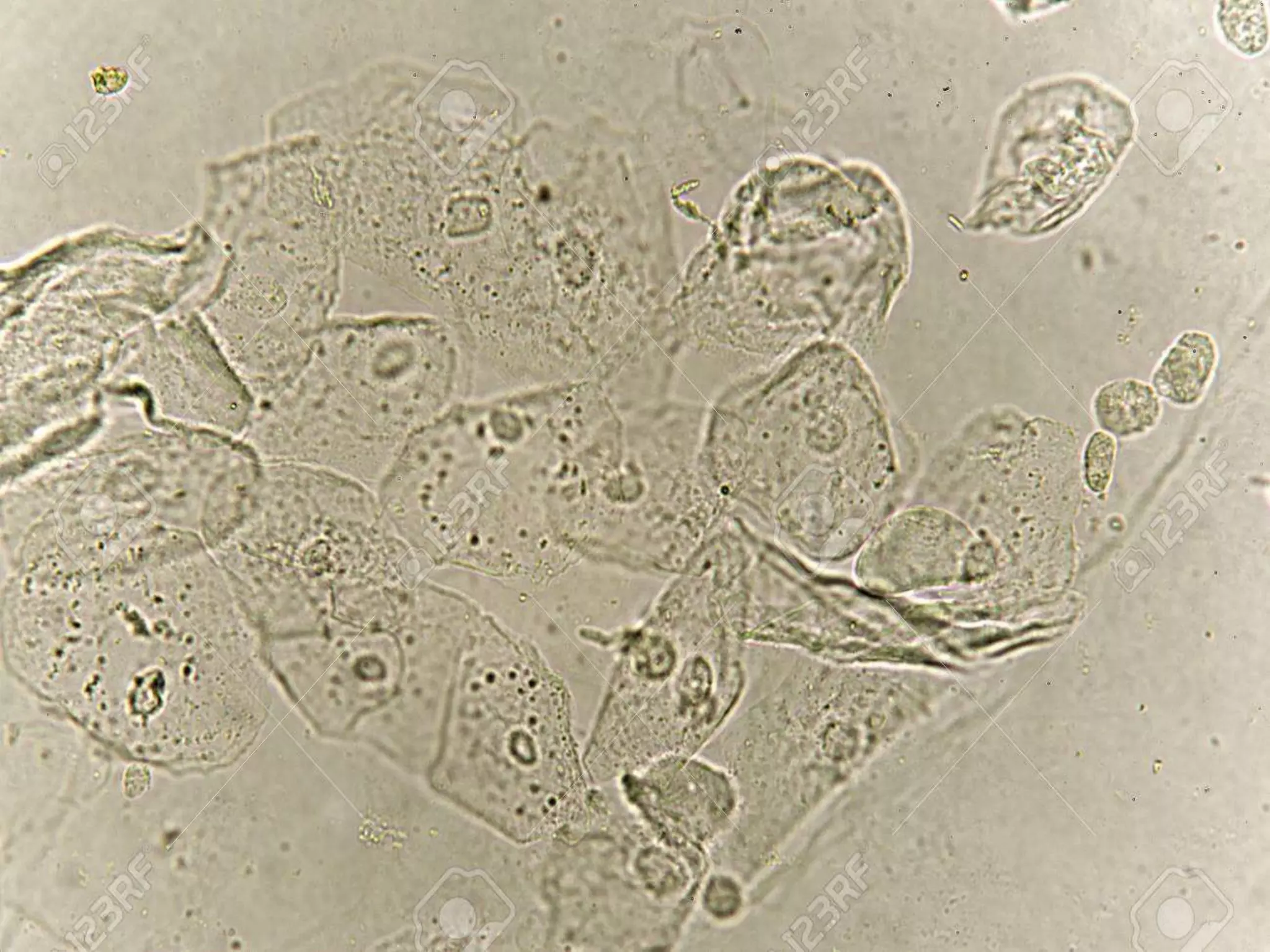 Microscopic examination of urine | PPTX