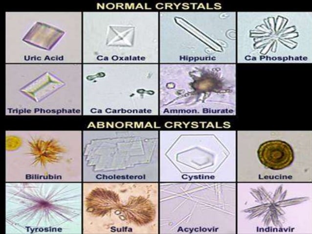 Microscopic examination of urine | PPTX