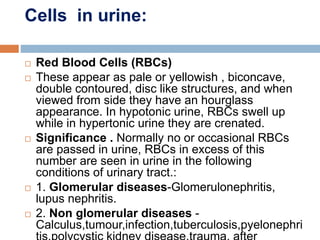 Microscopic examination of urine | PPTX