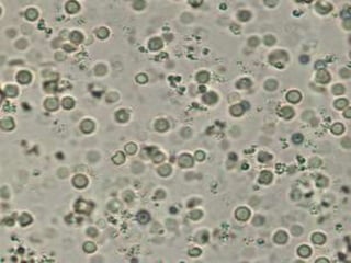 Microscopic examination of urine | PPTX