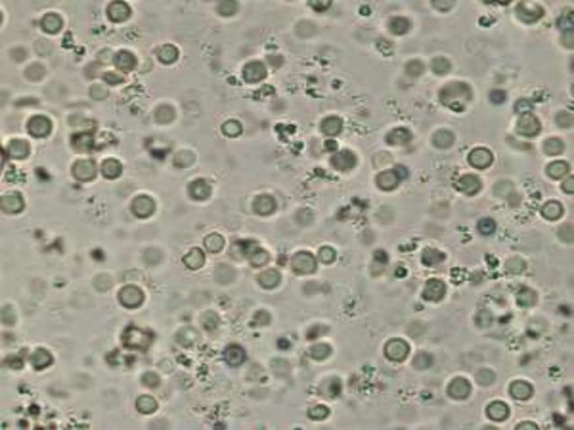 Microscopic examination of urine | PPTX